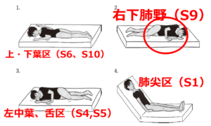 第108回（H31） 看護師国家試験 解説【午前41～45】 | 希望の解説ブログ